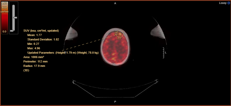 SUV measurement tools